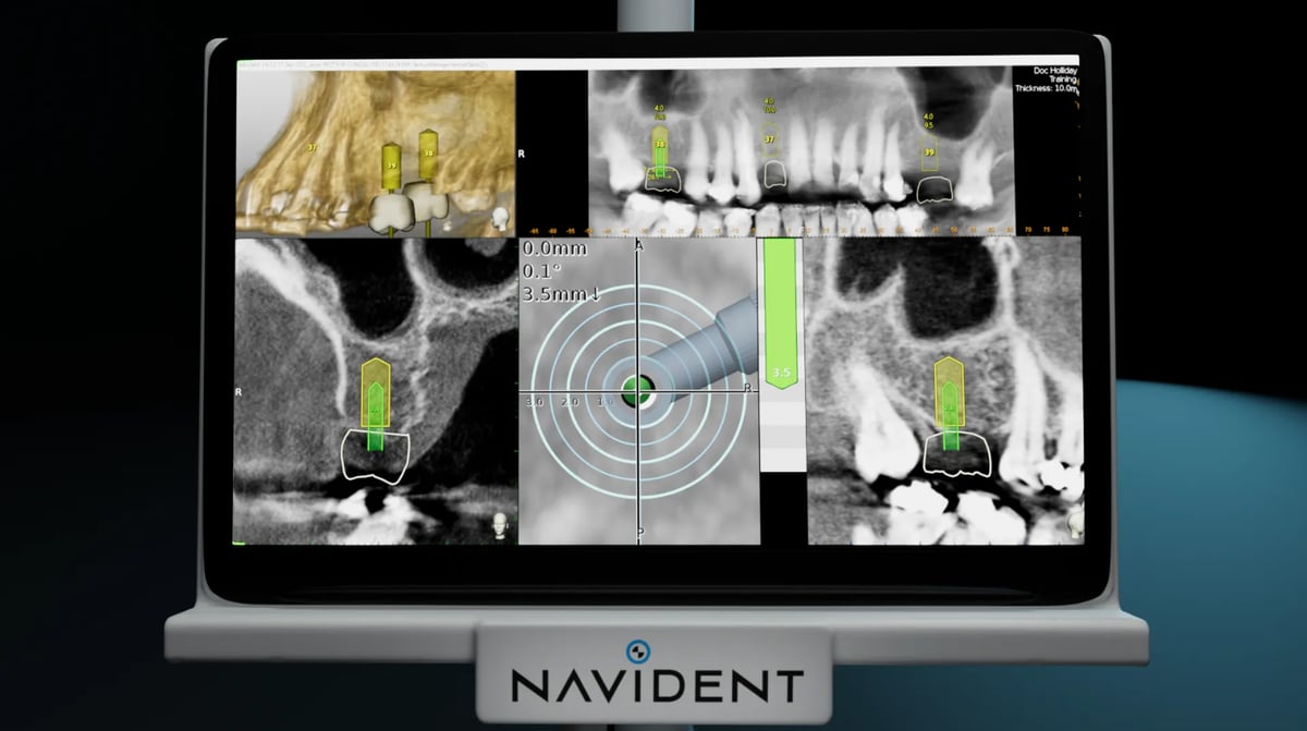 Navident - THE NEXT GENERATION OF DENTAL DYNAMIC NAVIGATION